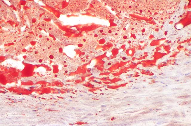 Sudan III soluzione alcolica satura | 0209297 | Histoline
